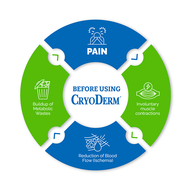CryoDerm Pain Relieving & Therapeutic Products Maximum Pain Relief